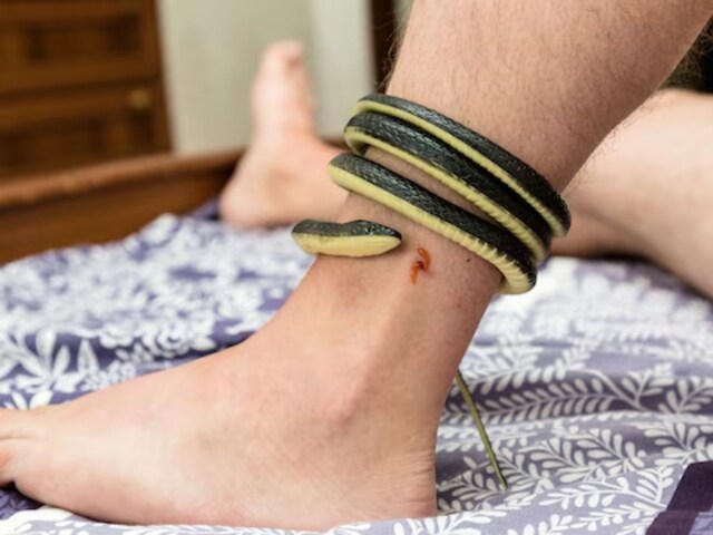 This Video Shows What Happens To Human Blood After Snakebite - News18