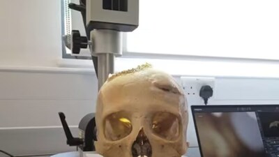 Research Shows Ancient Egyptians Attempted Cancer Surgery Over 4,700 ...
