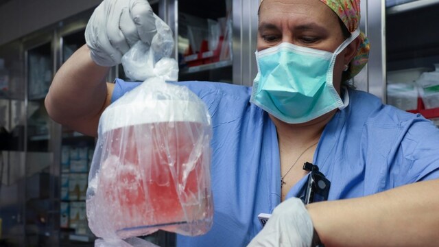 First Recipient Of Genetically Modified Pig Kidney Transplant Passes ...