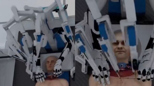Video Of World’s First Head Transplant System Will Make You Rub Your ...