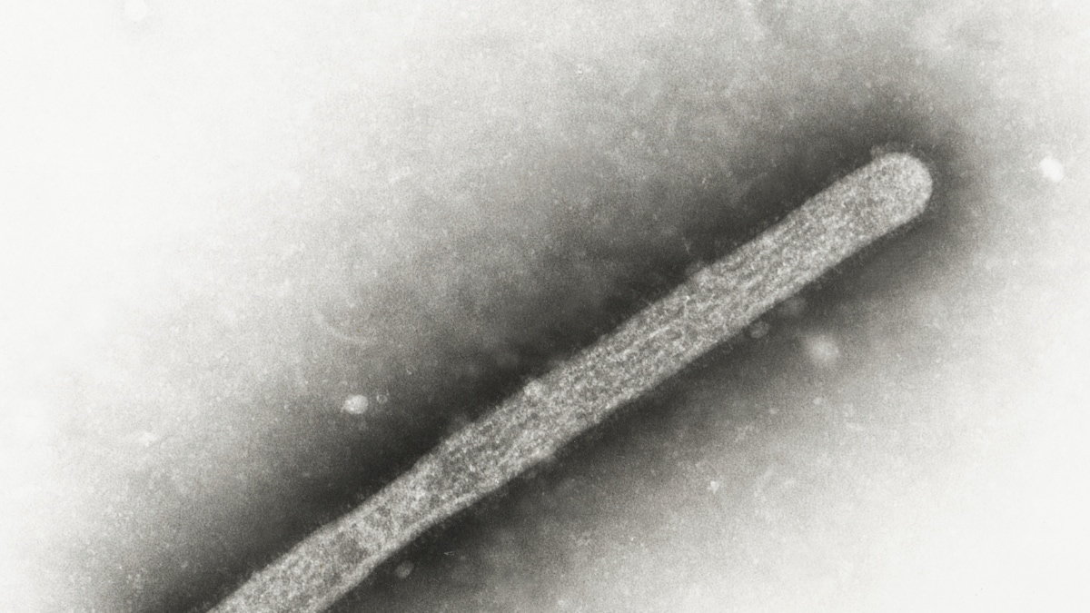 US Reports Second Human Case of Bird Flu Linked To Country's Dairy Cow ...
