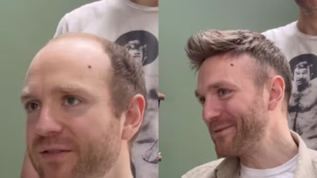 Video Of Bald Man's Incredible Hair Makeover Leaves Internet Amused ...