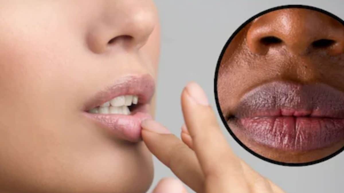 Why Do Smokers Lips Turn Dark - Infoupdate.org