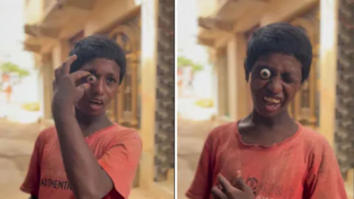Watch: Boy Makes His Eye Come Out From The Socket | Viral News - News18