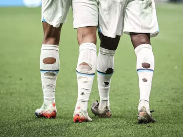 Why Footballers Have Holes In Their Socks - News18