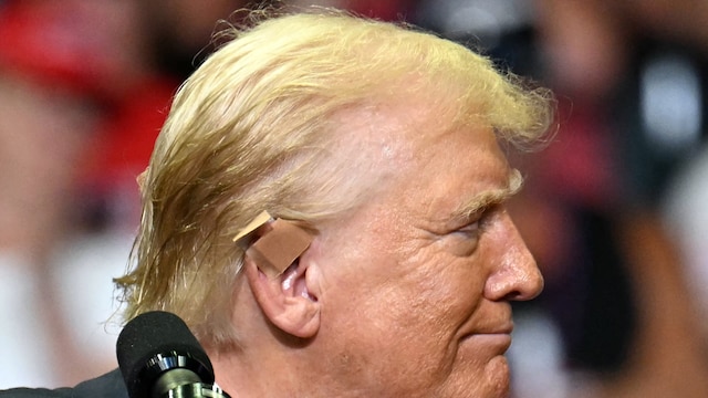 Bullet That Hit Trump's Ear Left 2cm Wound, Says Ex-White House Doctor ...