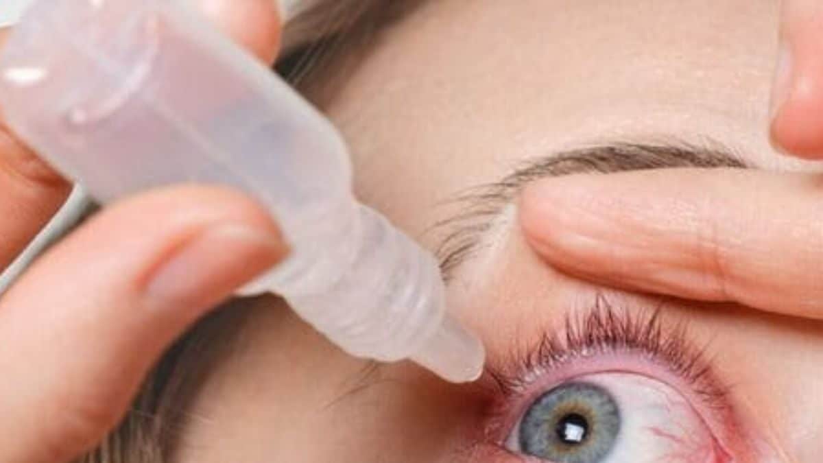 Eye Flu Spreading Rapidly in UP's Baghpat; Doctors Suggest Essential ...
