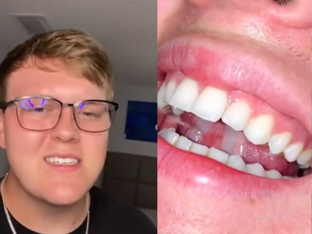 What Is Gleeking And Why Is It Trending On Social Media? - News18