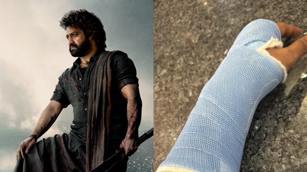 Jr NTR Injures Hand During Gym Session, Wears a Cast To Complete Devara Shoot | Photo Goes Viral ...