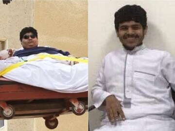 World’s Heaviest Man, Who Weighed Over 610 Kilos, Sheds 89% Of His Weight With Help From Saudi ...