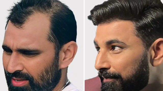 Boney Kapoor to Mohammed Shami: Meet the Doctors Behind Successful ...