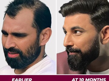 Boney Kapoor to Mohammed Shami: Meet the Doctors Behind Successful ...