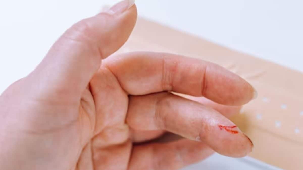 Danish Researcher Explains Why Paper Cuts Hurt So Much | Viral News ...