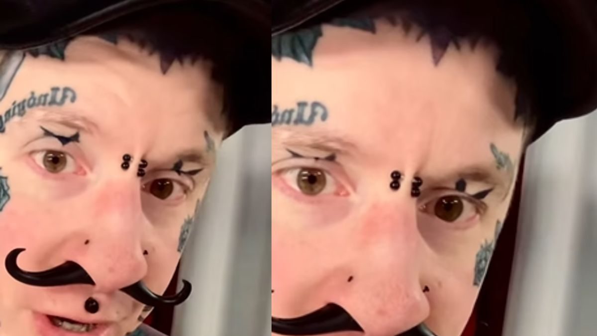 This Man’s Shocking Nose Transformation Video Has Everyone Talking ...
