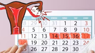 Decoding PCOS: Understanding The Causes, Symptoms And Treatments ...