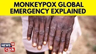 Explained: What Is Monkeypox And Why Is It A Global Threat - News18