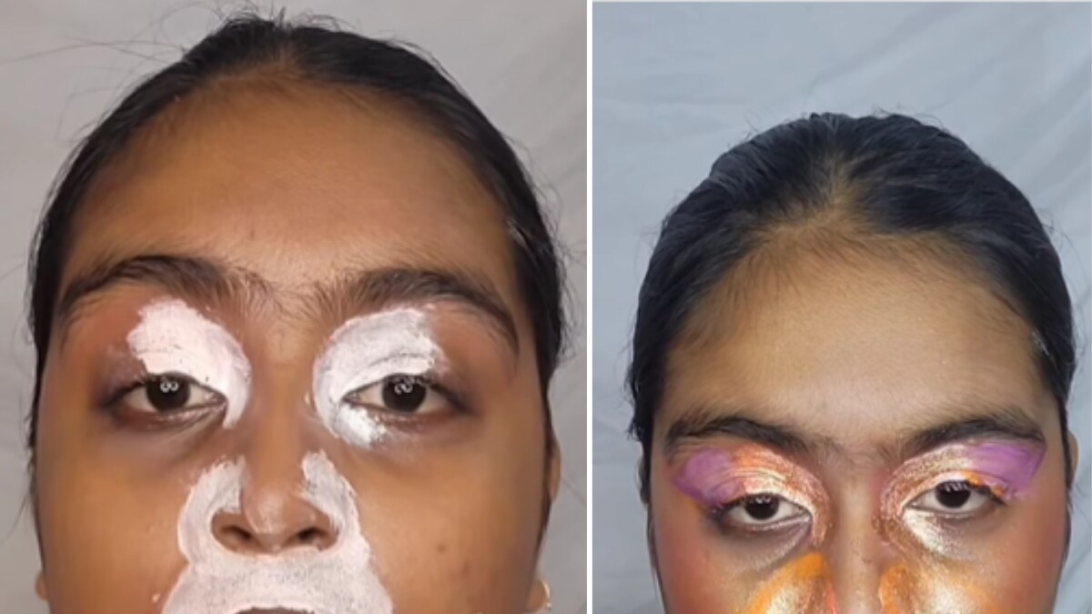 Woman's 'Vitiligo-Inspired' Makeup Tutorial Sparks Outrage: 'This Is So ...