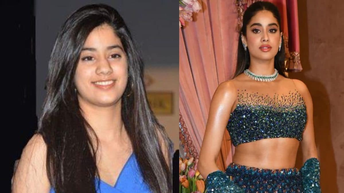 Celebrity Secrets: The Latest Plastic Surgery Trends in Bollywood ...