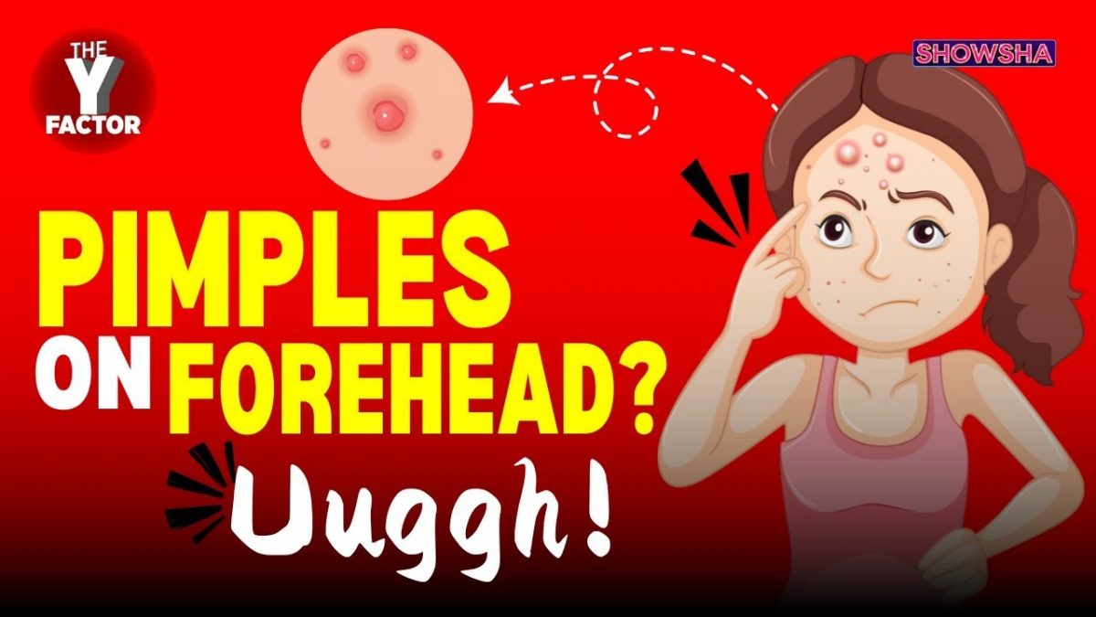 Why Do We Get Pimples On Our Forehead & What Is Our Skin Telling Us ...