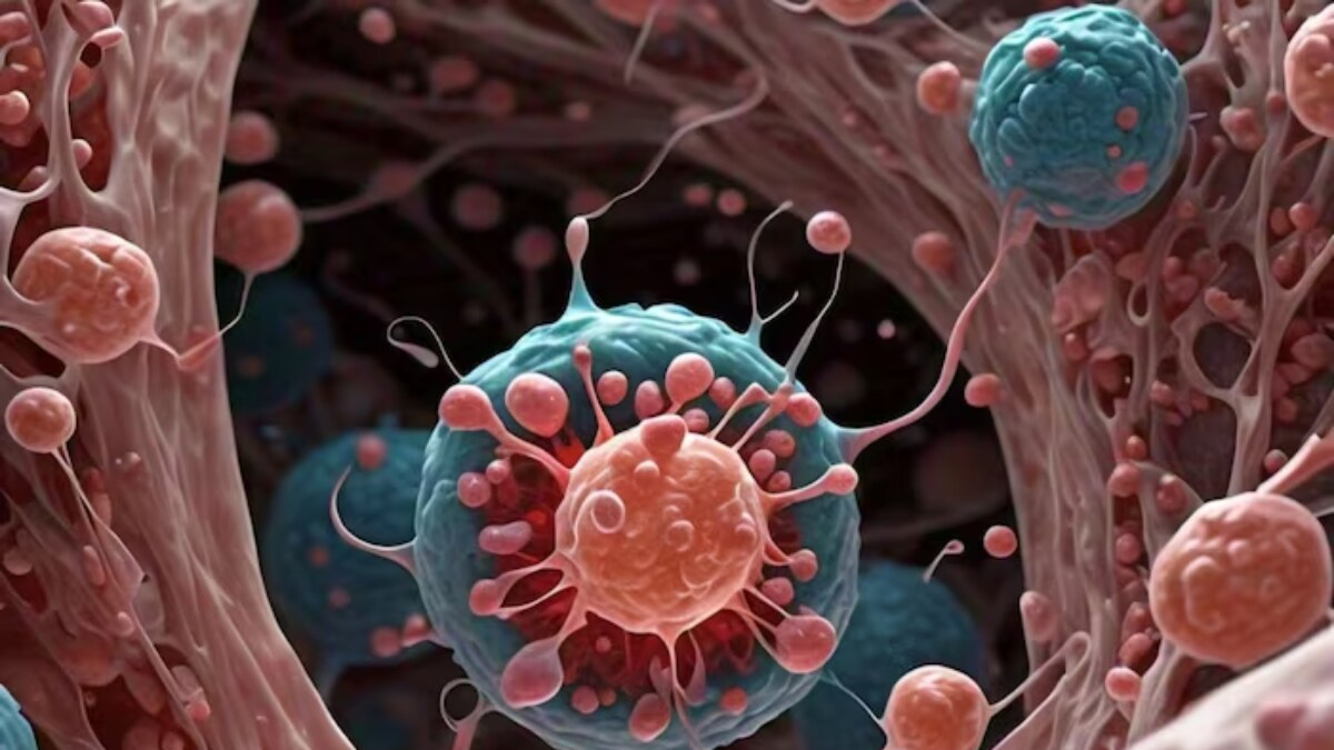 Colorectal Cancer: Causes, Symptoms, Detection and Treatment - News18