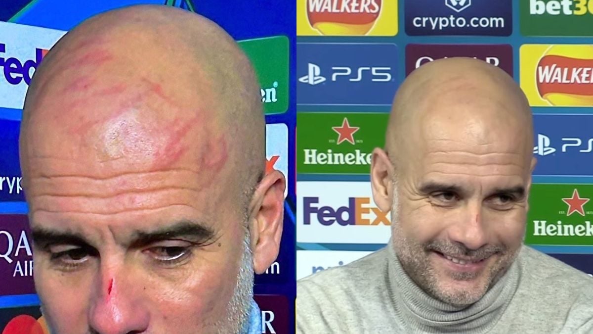 'He's Losing It': Social Media Erupts Citing Pep Guardiola's Scars ...