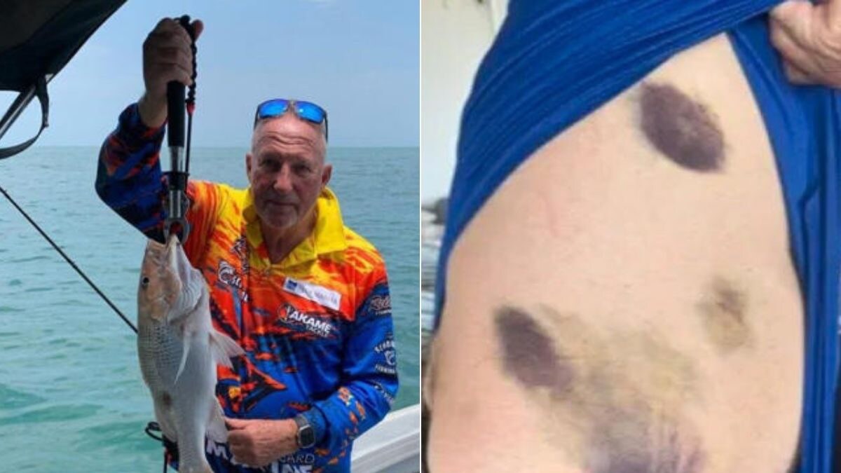 Ian Botham Suffers Bruises After Falling Into Crocodile-Infested River ...