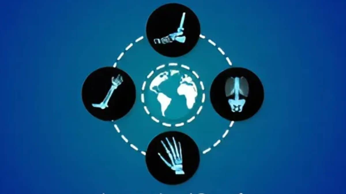 World Radiography Day 2024: Theme, History And Significance | Lifestyle ...