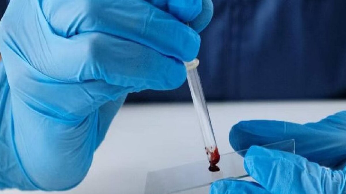 Man Takes DNA Test After Doubt Over Daughter's Looks, Gets Shocking ...