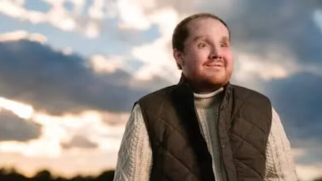 10 Years After Suicide Attempt, US Man's Rare Face Transplant Gives Him ...