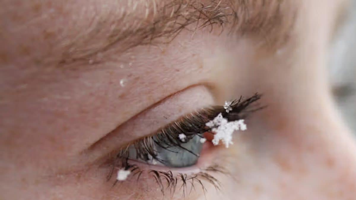 Expert Tips For Maintaining Eye Health During Winter: All You Need To ...