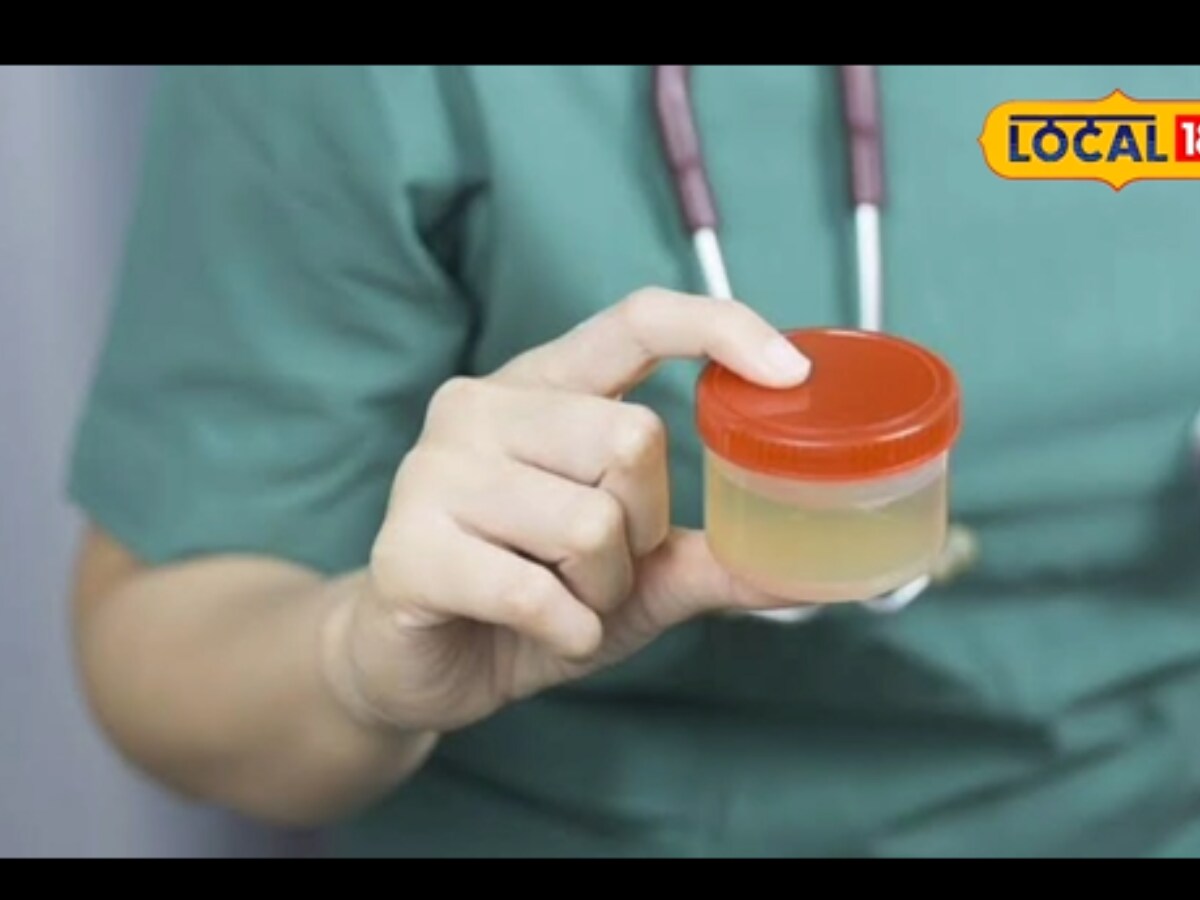 Foam In Urine Could Be A Sign Of Protein Loss, Here's How To Prevent It ...