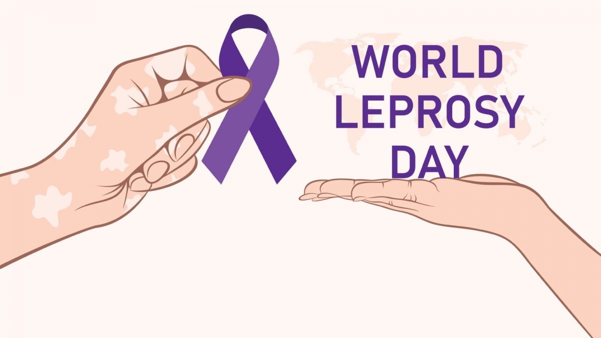 World Leprosy Day 2025: Theme, History, Significance, Leprosy Causes ...