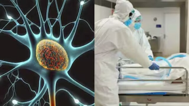 Pune Reports 9 New Cases Of GBS, Tally Goes Up To 110; Sample Testing ...