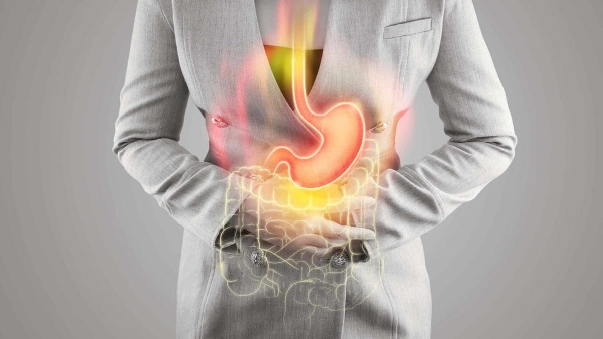 Understanding the Link Between Gastric Ulcers and Stomach Cancer Risk ...