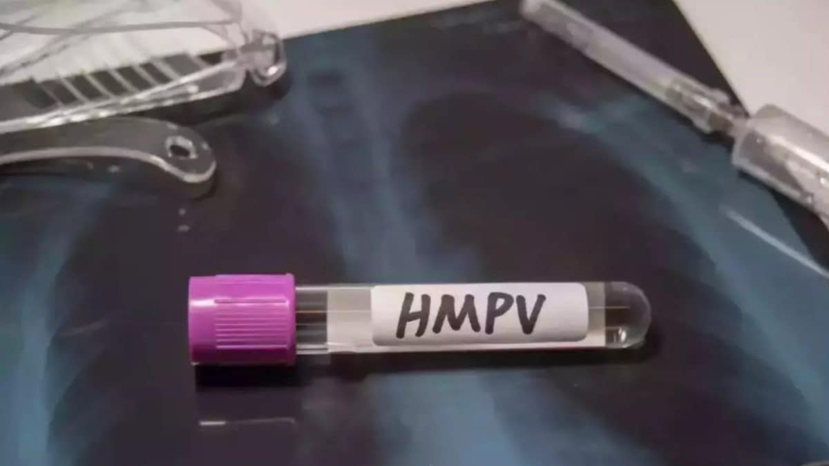 HMPV: Symptoms, How It Spreads, And How To Stay Safe