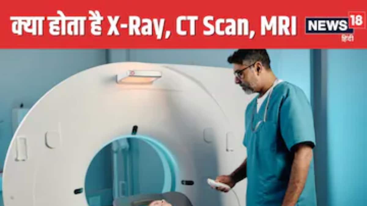 What Is The Difference Between X-Ray, CT Scan And MRI? | Lifestyle News ...