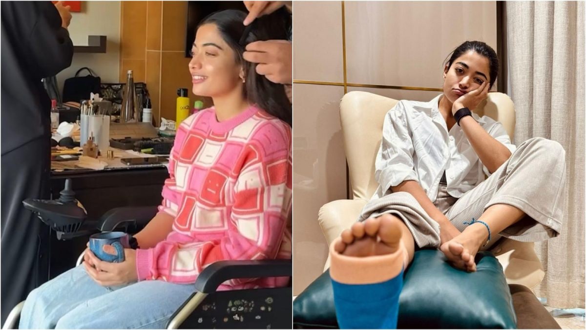 Rashmika Mandanna Shows X-Ray Of Injured Foot With 3 Fractures And A ...
