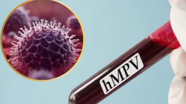 HMPV Symptoms And Treatment: How Common Is The Virus And How To Take ...