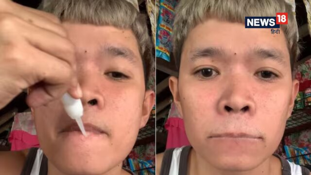 Boy’s Prank Turns Into Panic As He Seals His Lips With Superglue ...