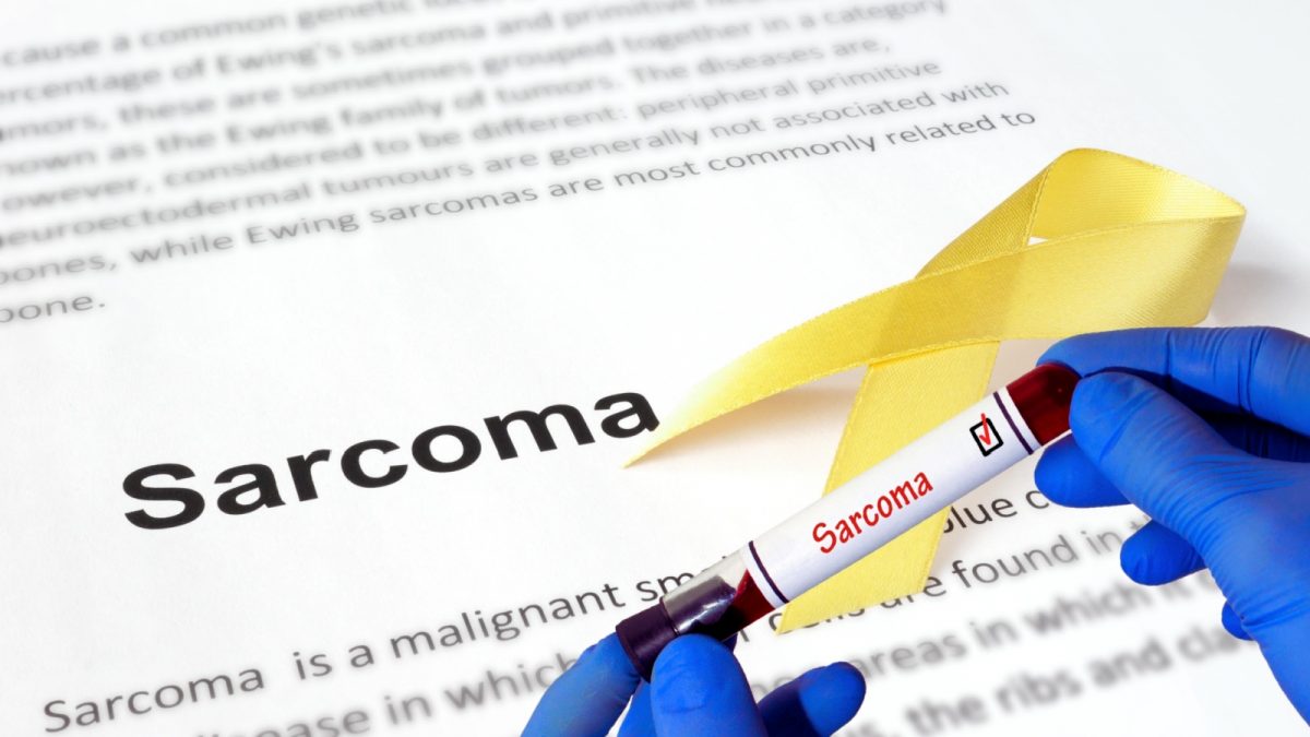 Why Is Clear Cell Sarcoma So Aggressive? | Health and Fitness News - News18