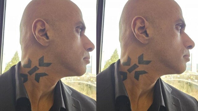 Melanoma Cancer Tattoos