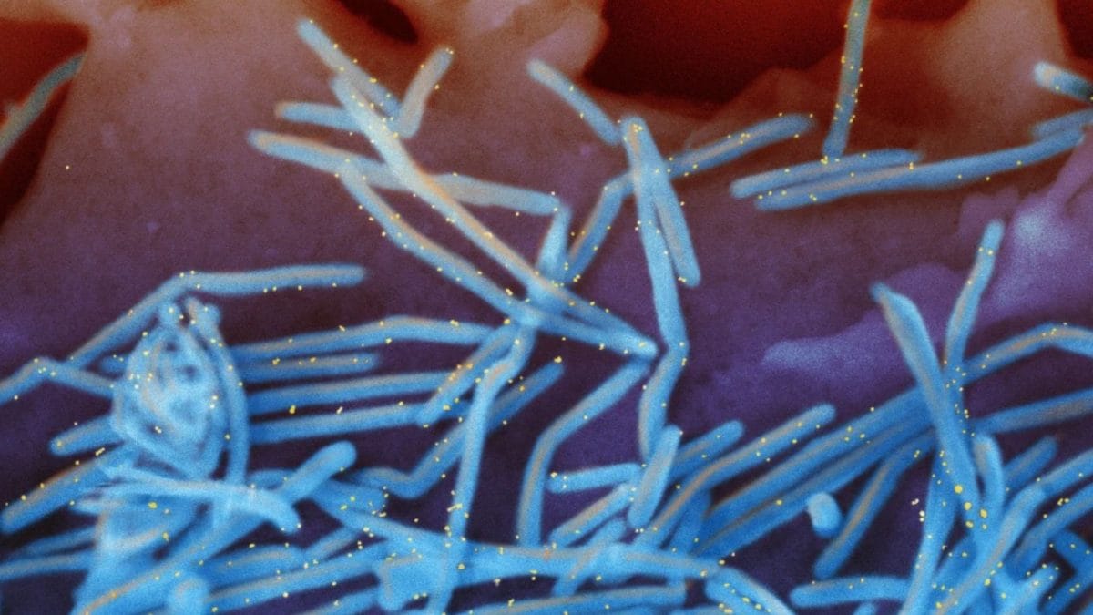 GBS Outbreak In Maharashtra: Mumbai Reports First Case, Pune Tally ...