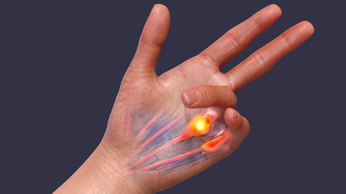 The Role of Fascia in Musculoskeletal Health: New Techniques for Fascia ...