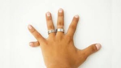 What Is Polydactyly? The Science And Mystery Behind Having Six Fingers ...