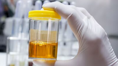 Why Is Human Urine Pale Yellow? What Does Change In Colour Mean ...