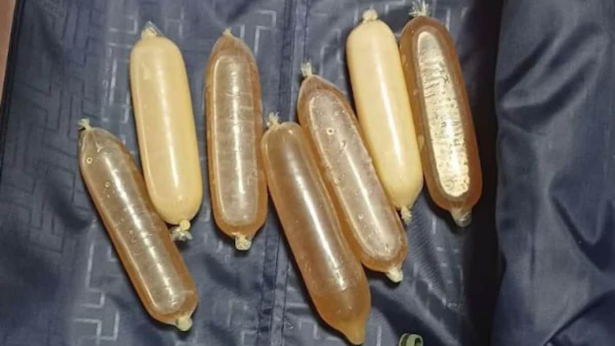 Liquid Cocaine Worth Rs 11 Crore Found Stitched In Brazilian Woman's ...