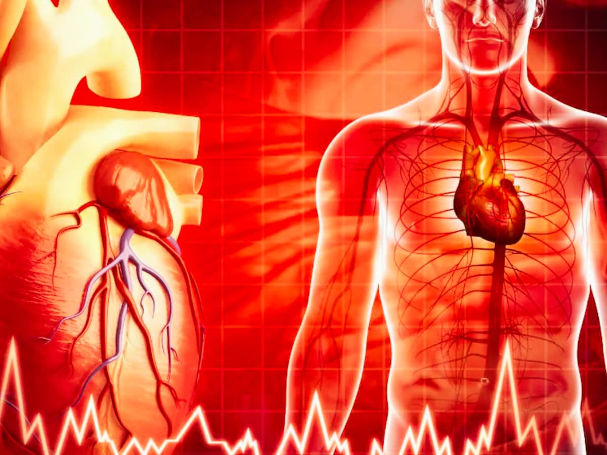 Circulatory System Heart Attack
