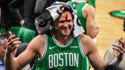 WATCH: Celtics' Kristaps Porzingis Takes Free Throws While Gushing ...