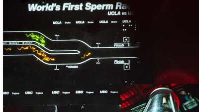 'Dystopian Future With No Babies': LA Students Organise 'World's First' Sperm Race | World News ...