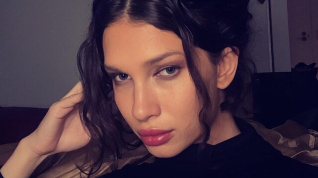 This Australian Woman Spent Rs 6 Lakh On Cosmetic Procedures To Look ...